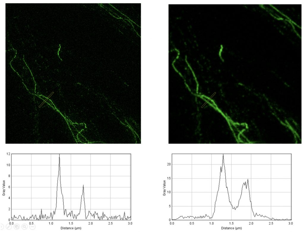 Fluorescence Nanoscopy, CIML platform | PICsL